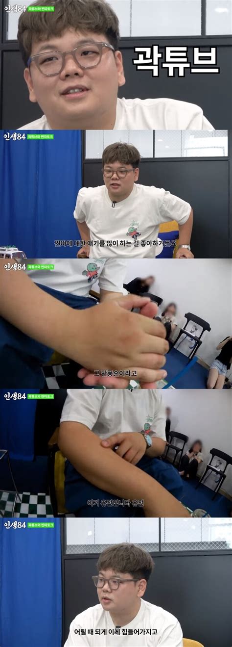 “유전병 더럽다고 애들이” 여행 유튜버 곽튜브가 힘들었다며 고백한 ‘학폭 피해는 분노와 안타까움이 동시에 치밀어 오른다