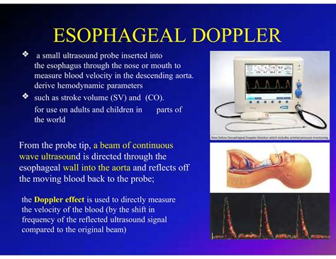 Cardiac Output Cardiac Output Monitoringpptx