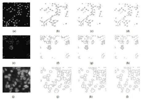 the three stage cell segmentation method a e i are three