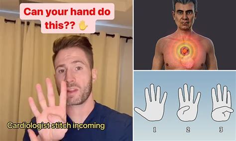 Er Doctor Claims Simple Thumb Test Can Tell If Youll Suffer A Deadly
