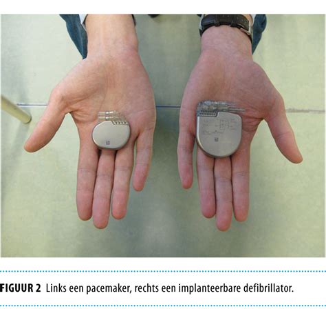 Icd Pacemaker Types Pacemakers And Icds An Implantable Cardioverter