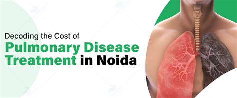 Decoding The Cost Of Pulmonary Disease Treatment In Noida