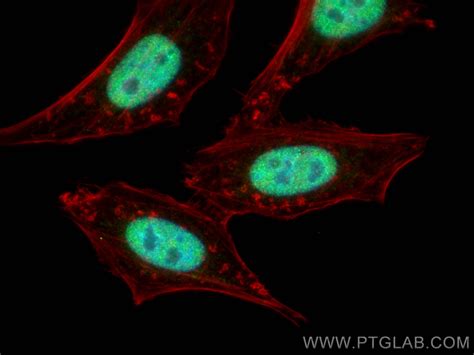 Kif23 Antibody 28587 1 Ap Proteintech