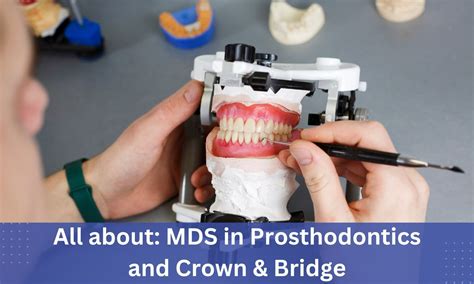 Mds Prosthodontics Crown And Bridge Admissions Dental Colleges Fees