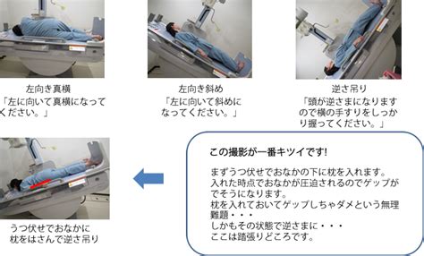 バリウム 飲み 方 コツ