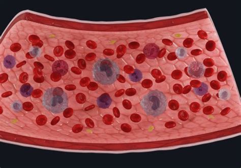 Your Guide To Hypergranulation Tissue Pictures And Effective Wound Care