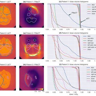 Image Variance Maps For The Three Patients For A D G PCT And B E