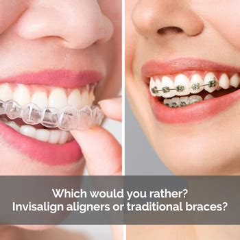 Invisalign Vs Braces Dental Partners Of Boston