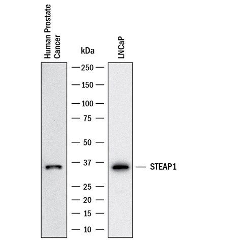 Anti Steap1 Antibody Mab55871 100 Randd Systems