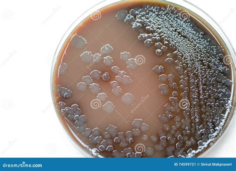 Bacterial Culture Growth On Chocolate Agar Gram Positive Bacilli