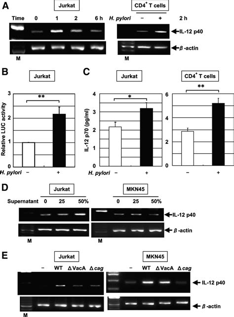 H Pylori Induced Il 12 P40 Mrna Expression In T Cells A Total Rna