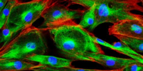 Newsletter Intracellular Flow Cytometry Fundamentals Fluorofinder