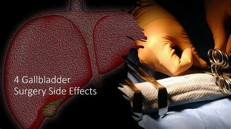 Gallbladder Surgery Human Organ Side Effects After Effects