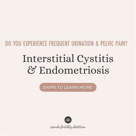 Interstitial Cystitis And Endometriosis Cystitis Interstitial Cystitis Endometriosis