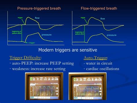 Anatomy Of The Ventilator