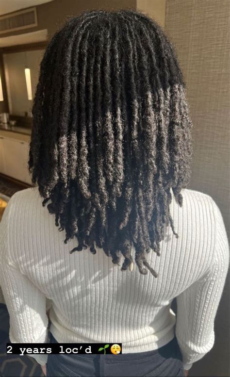 How To Soothe Itchy Scalp Without Damaging Your Roots Artofit