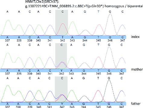Sanger Sequencing Electropherogram Of The Index Patient And His