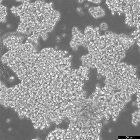 Nci H82 Cells