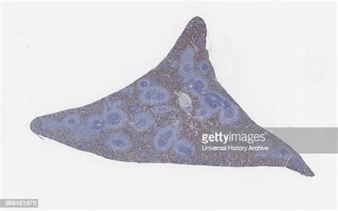 Immunoperoxidase Staining Of Normal Formalin Fixed News Photo Getty Images