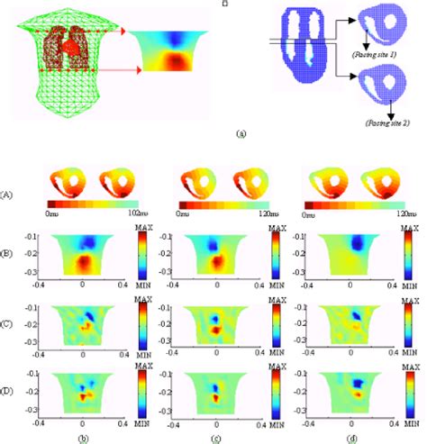 Figure 1 From A Spline Laplacian Ecg Estimator In A Realistic Geometry Volume Conductor