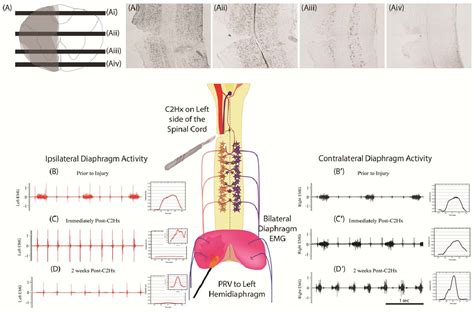 Figure 1 From Anatomical Recruitment Of Spinal V2a Interneurons Into Phrenic Motor Circuitry