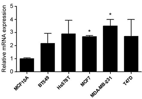 Figure 2 Abhd12 Knockdown Suppresses Breast Cancer Cell
