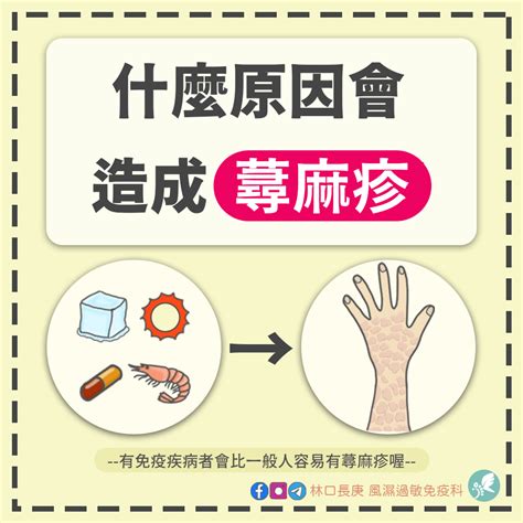 林口長庚風濕過敏免疫科 什麼原因會造成蕁麻疹 ️ 蕁麻疹是一種肉色地圖樣突起的表現，