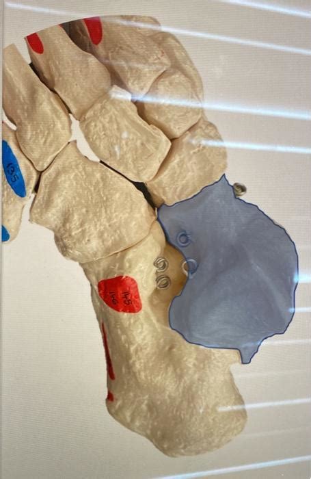 Solved Cuboid Lateral Cuneiform Navicular Intermediate