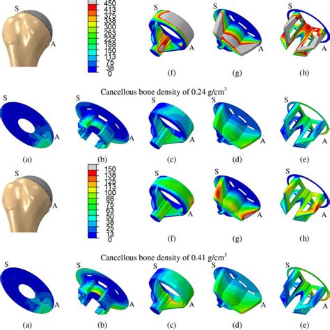 Dimensions Of The Stemless Shoulder Implants Modelled Download Scientific Diagram