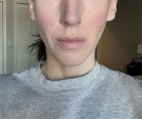 Update To Skin Texture Issue R 30plusskincare