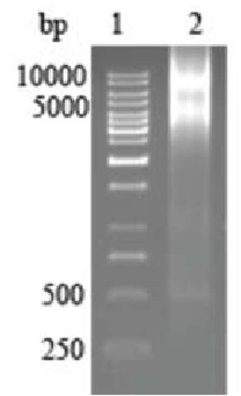 Amplification Of The Mouse Alpha Synuclein Gene Alpha Synuclein Was Download Scientific
