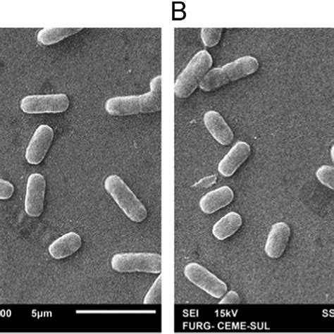 Scanning Electron Microscope Of Bacillus Cereus Native Strains 25 A