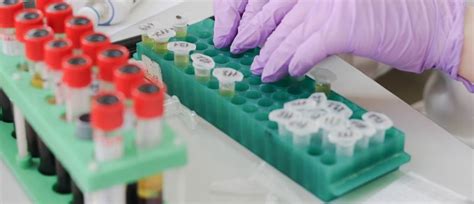 Charles River Acquires Cognate Bioservices Bioanalysis Zone