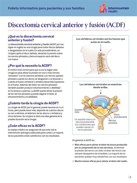 acdf anterior cervical discectomy and fusion fact sheet spanish