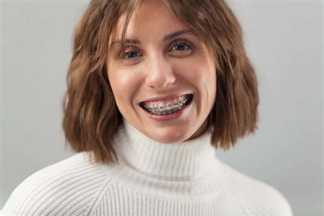 Dental Braces 101 Part 5 Impact On Your Self Esteem Archwired