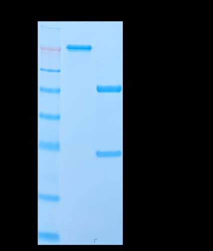 Igd Immunoglobulin Delta Heavy Chain B Cell Marker Recombinant