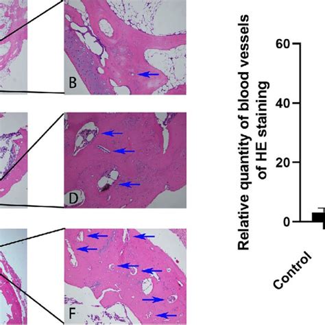 H And E Staining Of The Bone Defect Area In Each Group At 12 Weeks