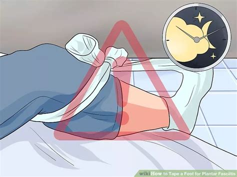3 Ways To Tape A Foot For Plantar Fasciitis Artofit