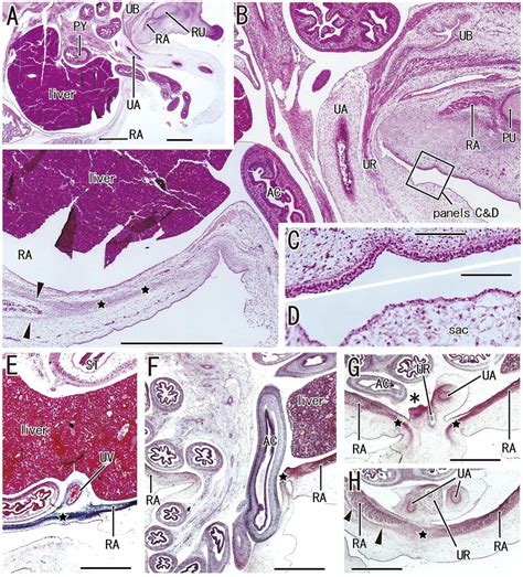 Umbilicus During Physiological Herniation He Staining Lower Side Of Download Scientific