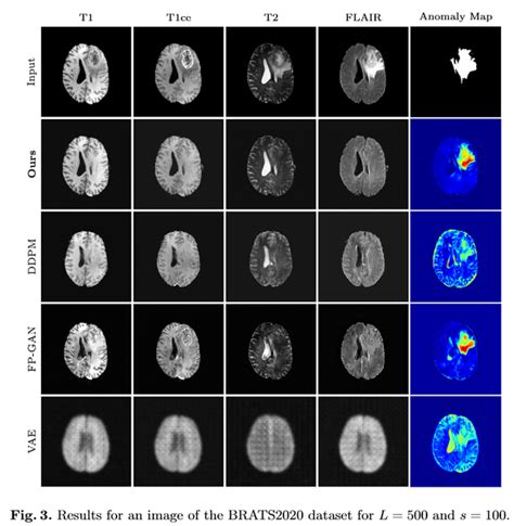 Diffusion Models For Medical Anomaly Detection