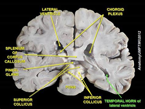 Corpus Callosum Function Etymology Location And Anatomical Structure