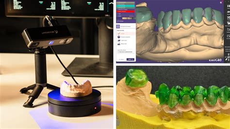 Scan Design Print Cast The Digital Dental Workflow
