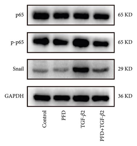 Effect Of Pfd On Tgf β2 Induced Activation Of The Nf κbsnail Signaling