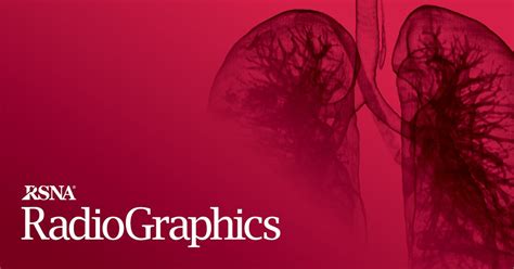 Radiological Society Of North America Rsna On Linkedin Rsna Is