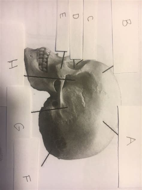 Axial Skeleton Diagram Quizlet