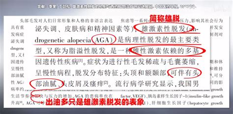 雄激素性脱发，会自动停止吗？ 哔哩哔哩