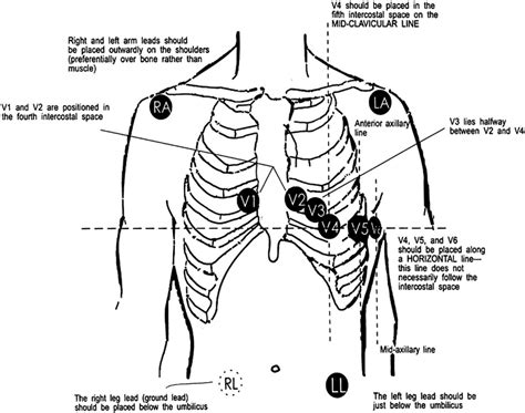 Holter Electrode Placement Instructions Kuvjye
