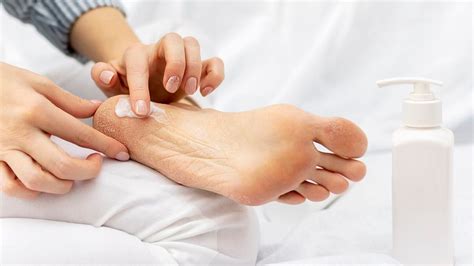 ¿cómo Usar El Bicarbonato Para Los Pies Agrietados