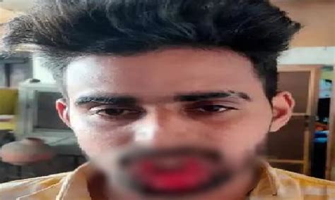 युवक कर रहा था लड़की को जबरन Kiss फिर लड़की ने काटकर होठ किये अलग अब