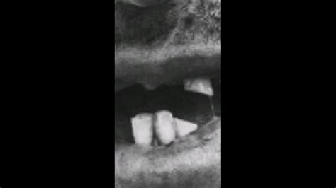 Japanese Scientists Discover How To Regrow Teeth Using Stem Cells